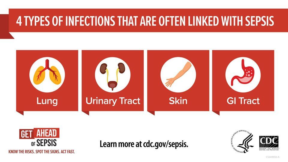 4 Types of Infections That Are Often Linked With Sepsis