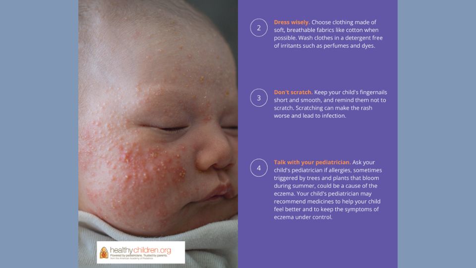 Common Summertime Skin Rashes in Children